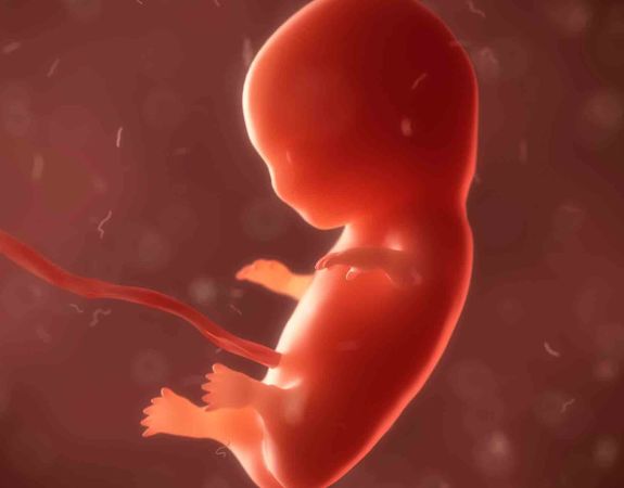 Feto Em Casos De Feto